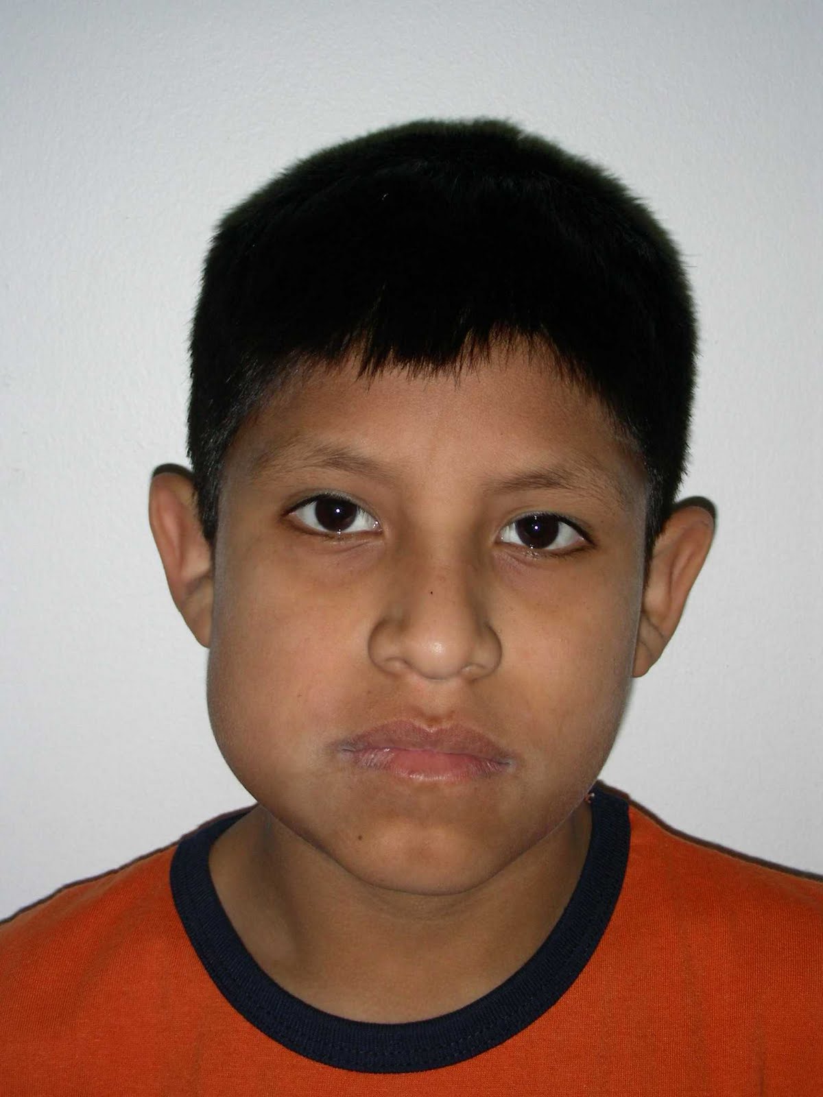 Corrección de Patologías estetica dental